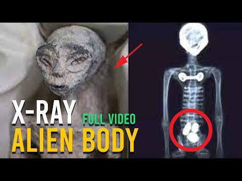 ENGLISH Mexico Alien X-Ray – Full Video (historic broadcast ...