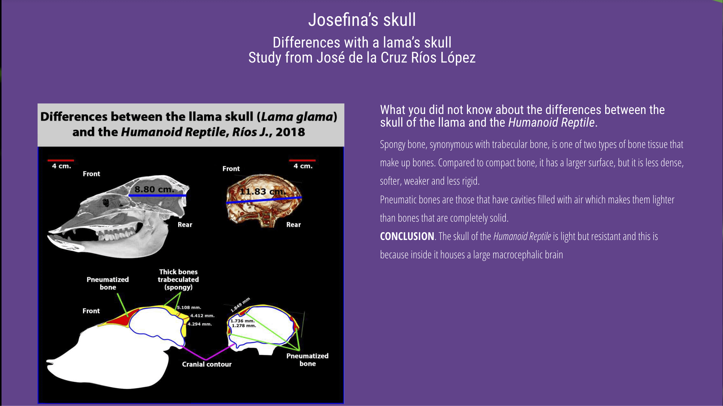 Nazca/Mexico Mummies Josefina’s Skull Compared to Llama’s Update – UFO FEED