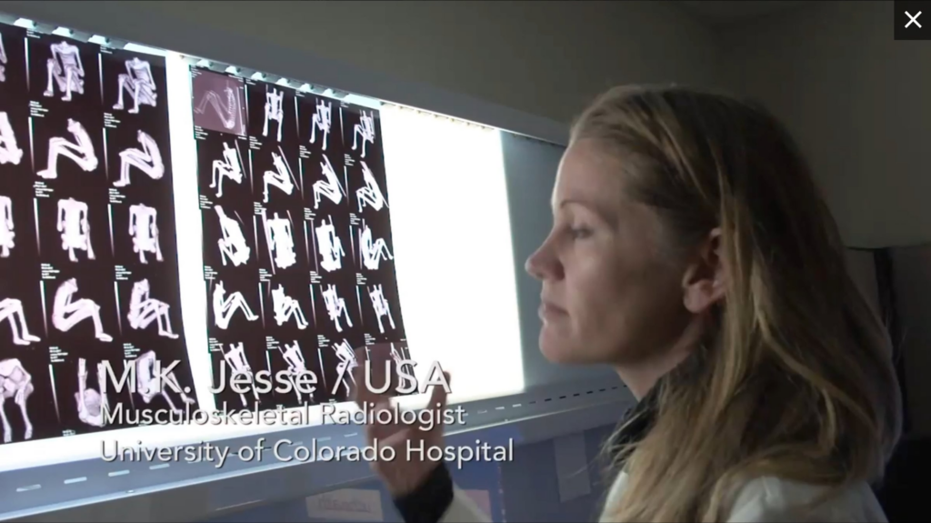 Dr. Mary K. Jesse from University of Colorado Hospital Examines ...