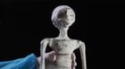 Dr. Jose Zalce Benitez, forensic specialist, examines x-ray scans of ...
