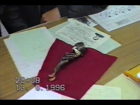 Alyoshenka The Kyshtym Dwarf The Original Video From 1996 Ufo Feed