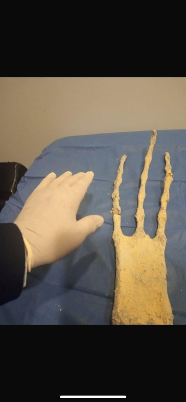 Dr. Piotti comparing his hand to the giant hand he’s studying in Mexico ...