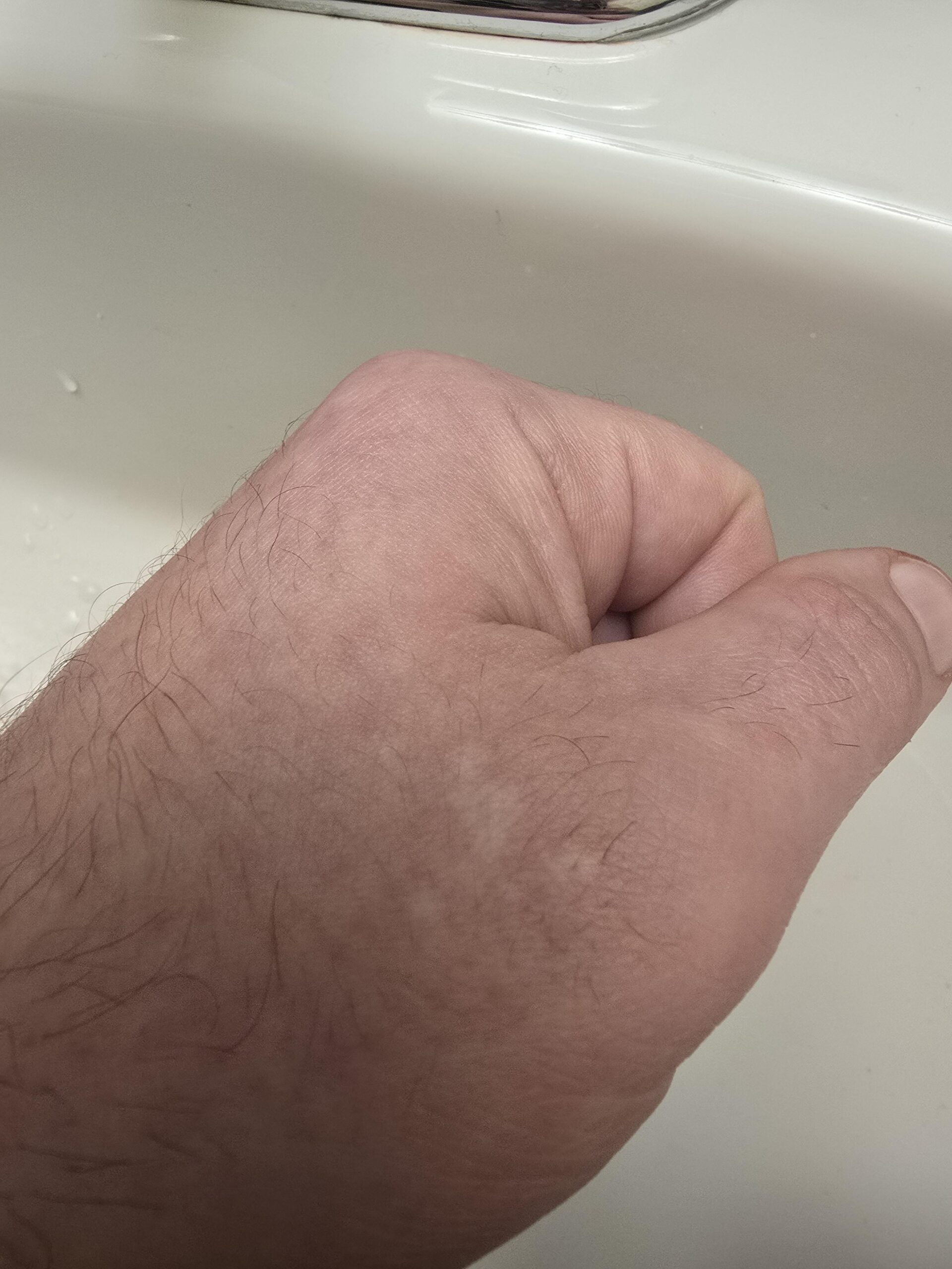 Weird triangle marking on on left hand. – UFO FEED