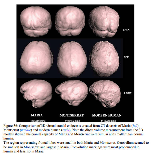 Updated report on Dr. Fung's virtual autopsy of Maria, a tridactyl ...